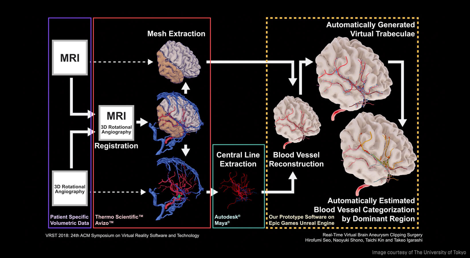Helping brain surgeons practice with real-time simulation - Unreal Engine