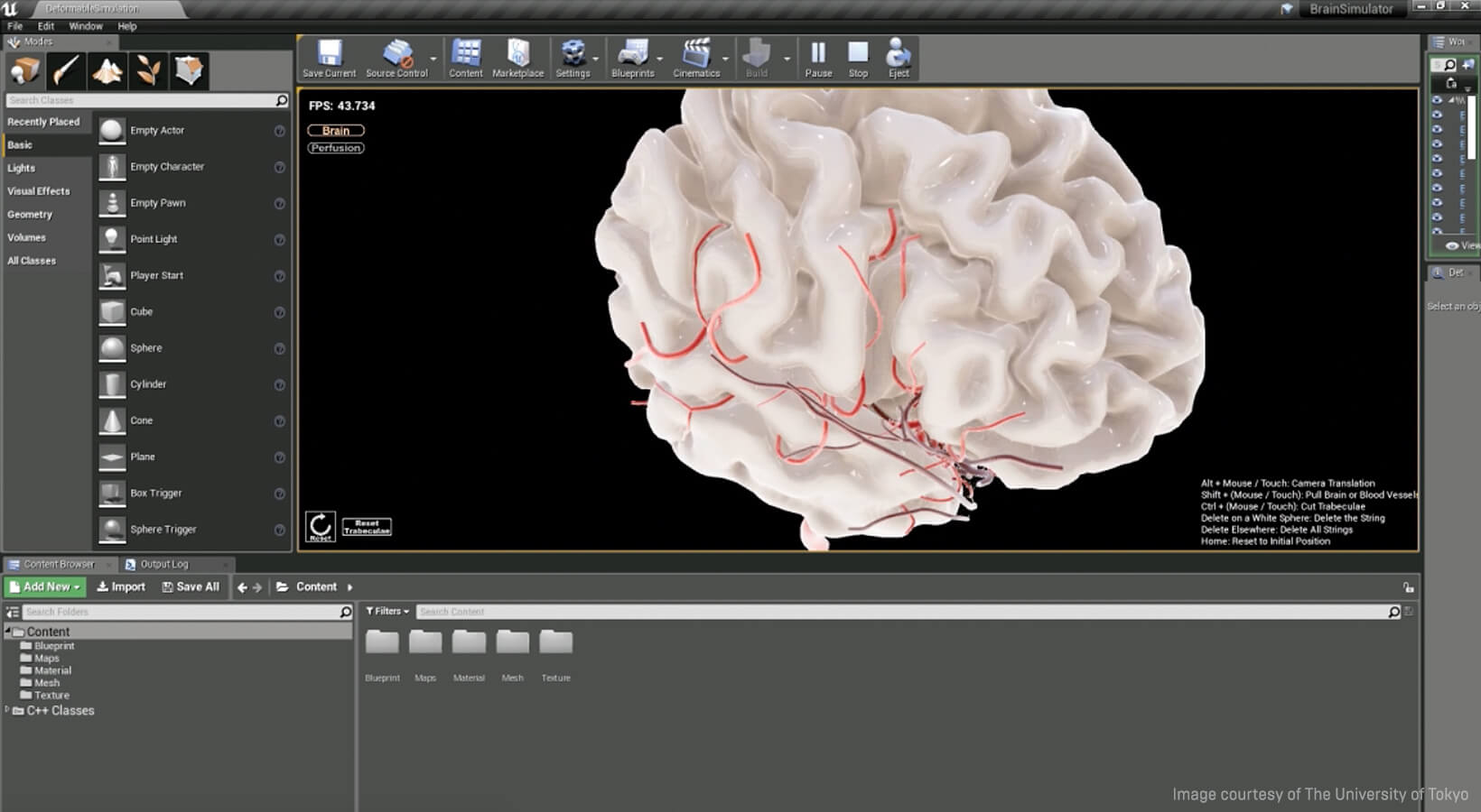 Helping brain surgeons practice with real-time simulation - Unreal Engine