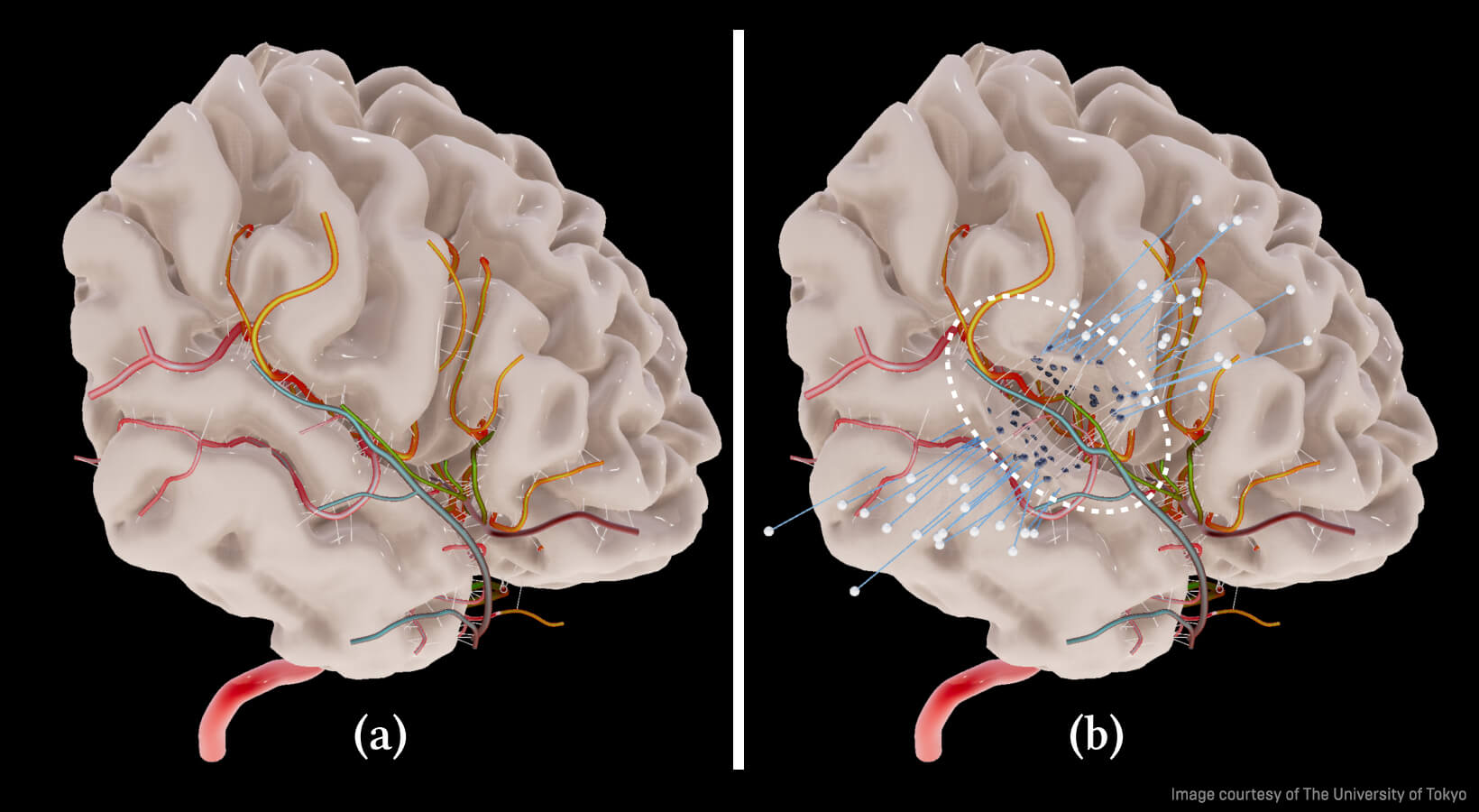Helping brain surgeons practice with real-time simulation - Unreal Engine